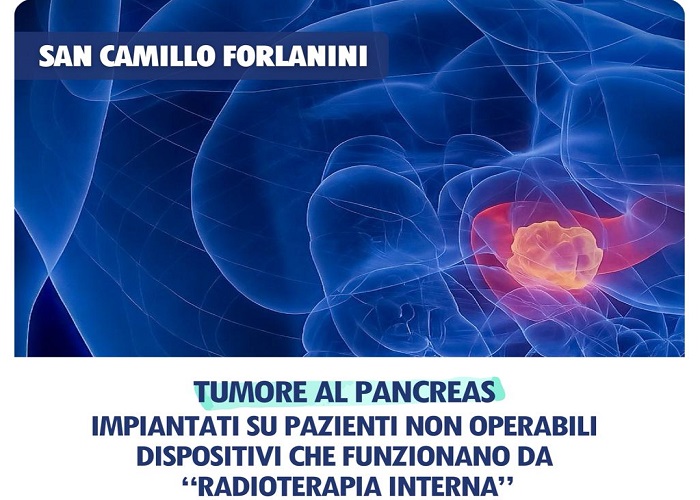 Tumore Al Pancreas, Al San Camillo Forlanini Conclusa Una ...